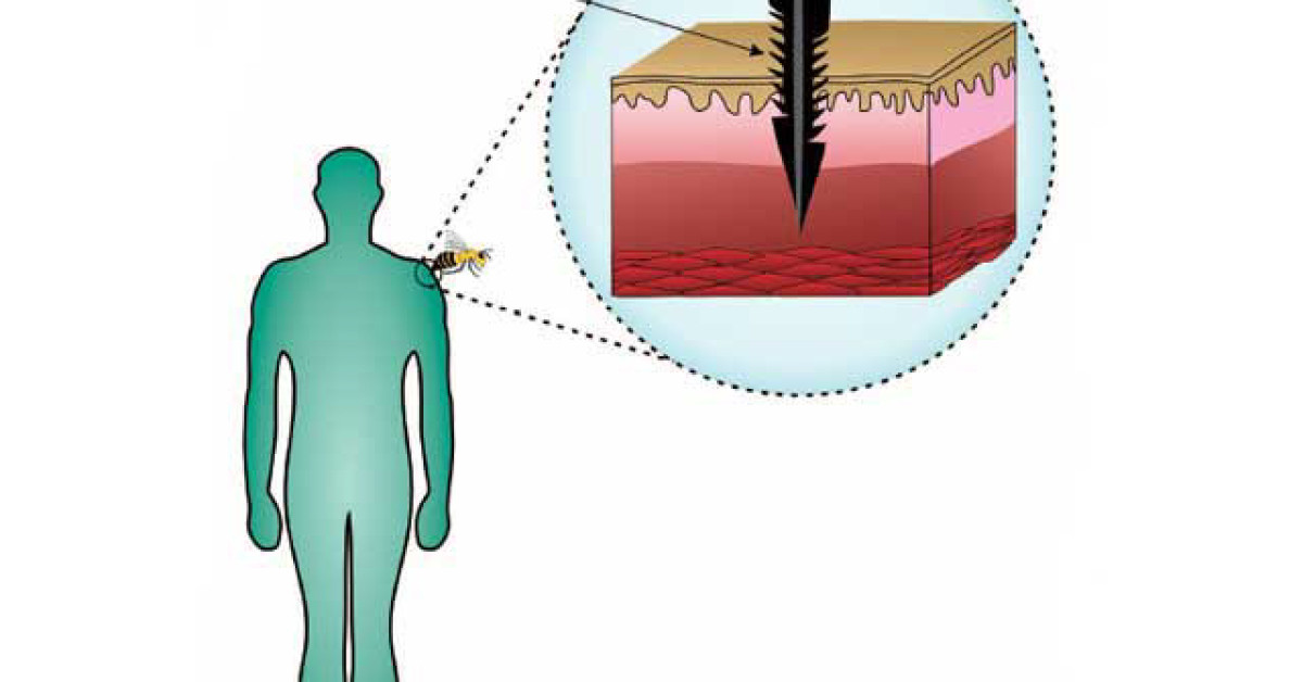 Bee sting Figure 2B Pucca et al 2019 image