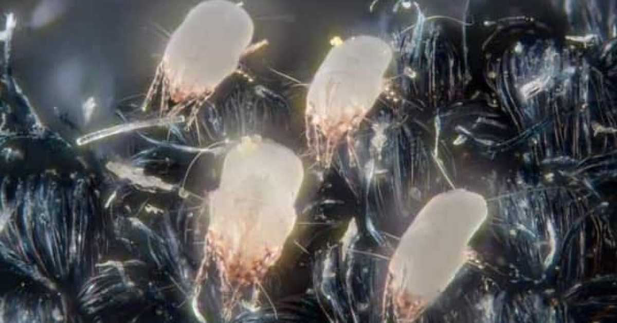 House dust mite - Dermatophagoides pteronyssinus image