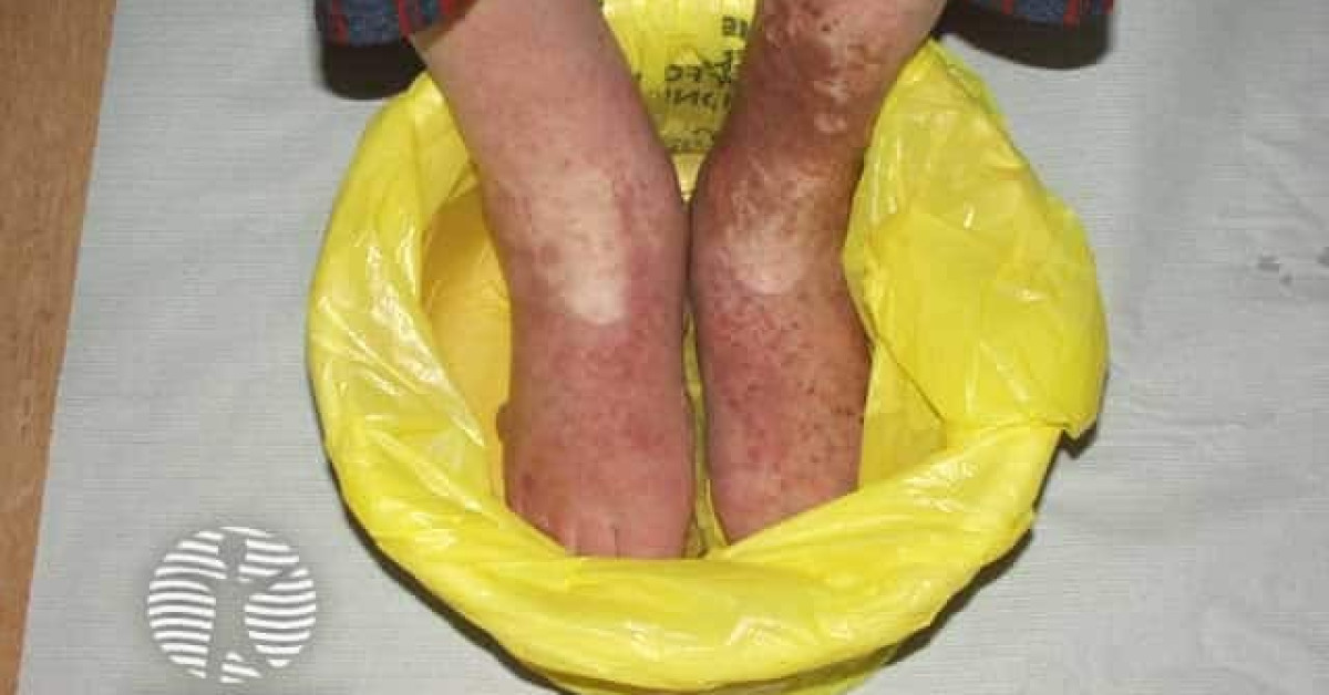 Potassium permanganate image