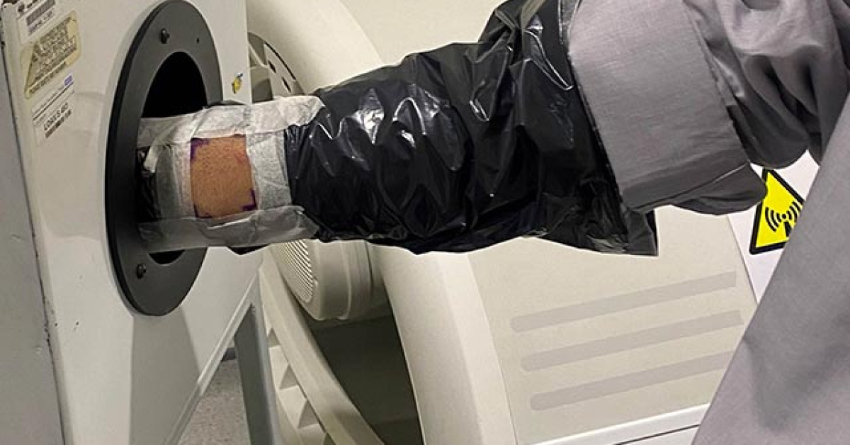 Ultraviolet provacation testing image