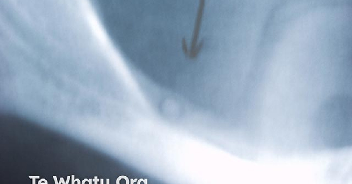 X-ray image of dental sinus close-up image