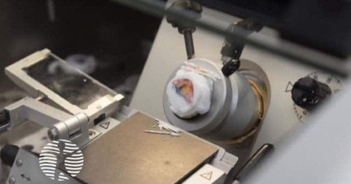 4 Mohs cutting frozen sections3 image