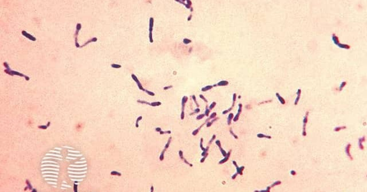 Corynebacterium diphtheriae Gram stain image