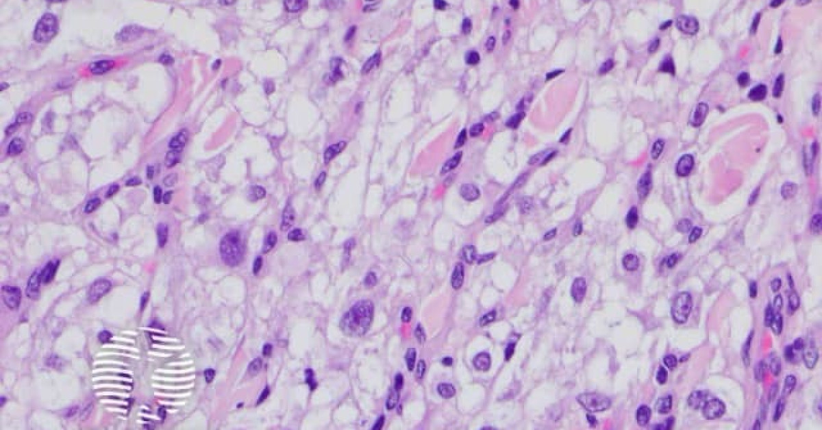 CCMN figure 3 image