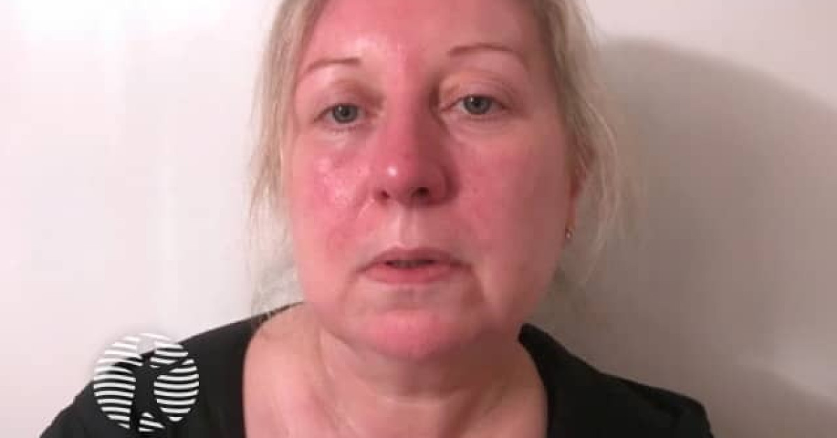 A red face and neck associated with COVID-19 image