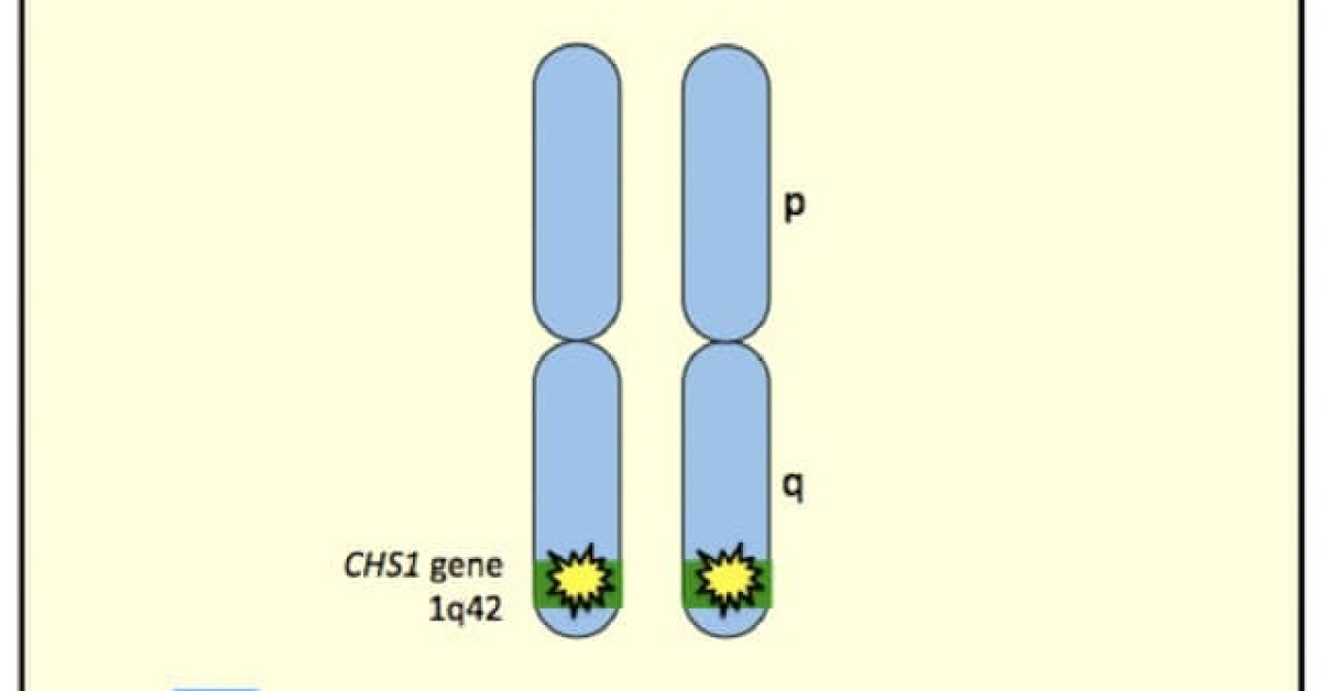 Chediak Higashi Syndrome image