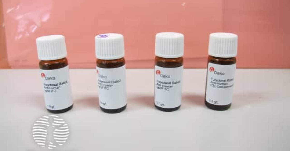 Reagents for direct immune fluorescence, antibody-fluorophores to IgG ...