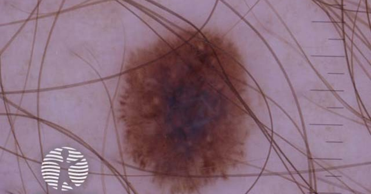 Perpendicular white lines nonpolarised view image