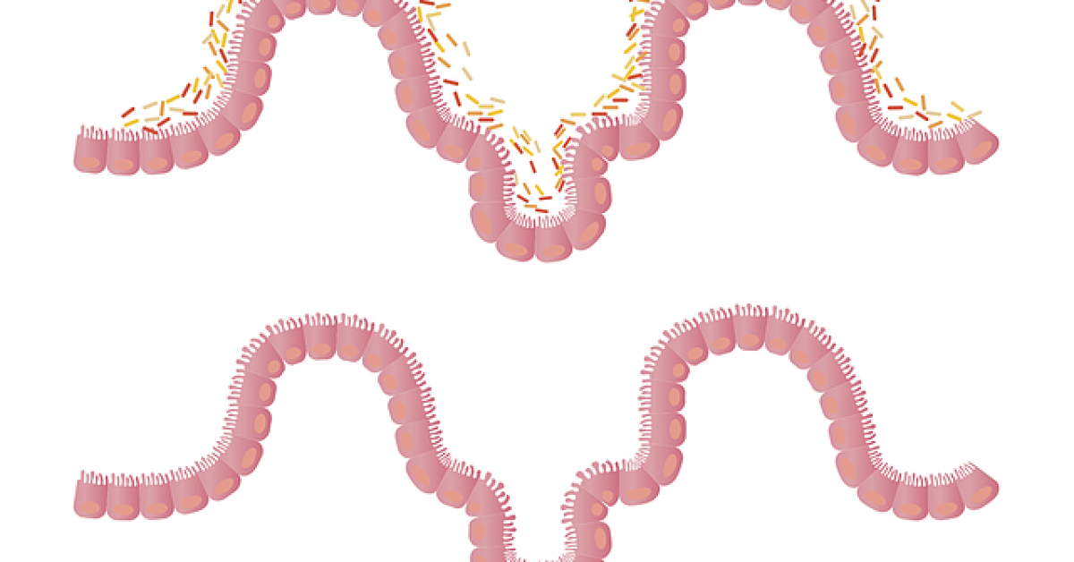 Representation of the intestinal lining with and without microbiota image