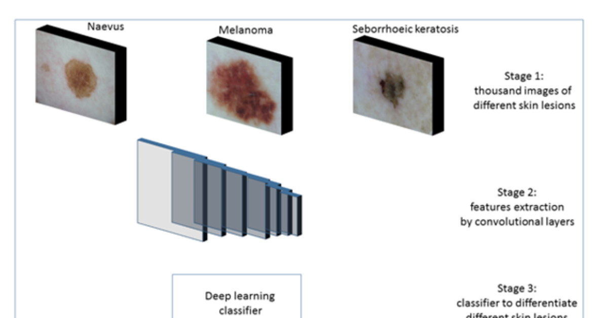 Skin Lesions Types Understanding Types Of Skin Diseases Treatment 2024