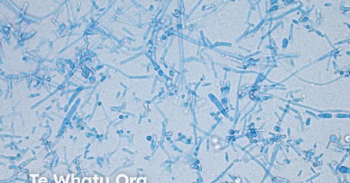 Dermatophyte microscopy image