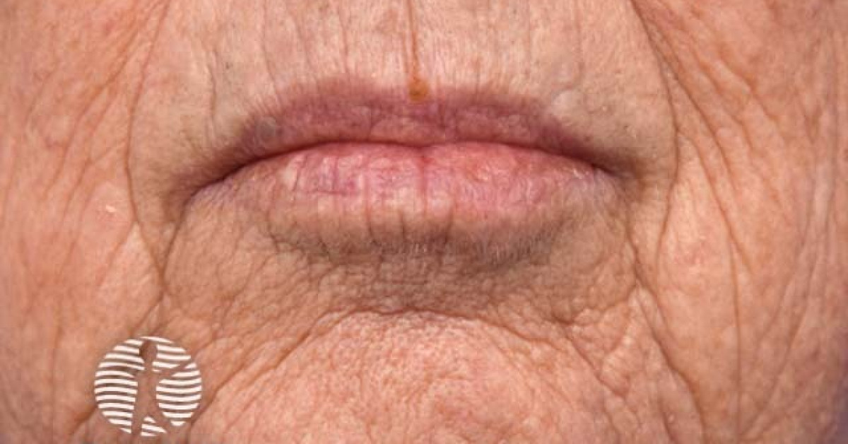 Ageing skin image