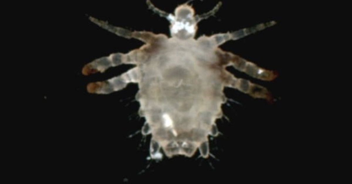 Pubic louse image