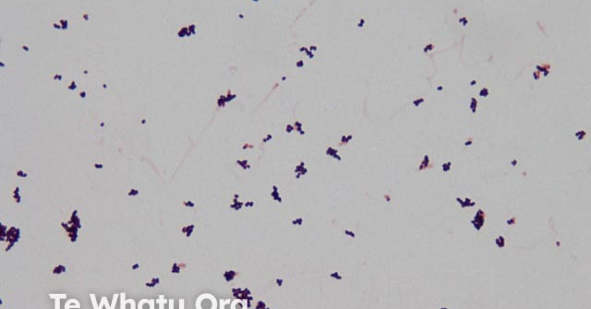 Gram stain of corynebacteria cultured from forearm skin image