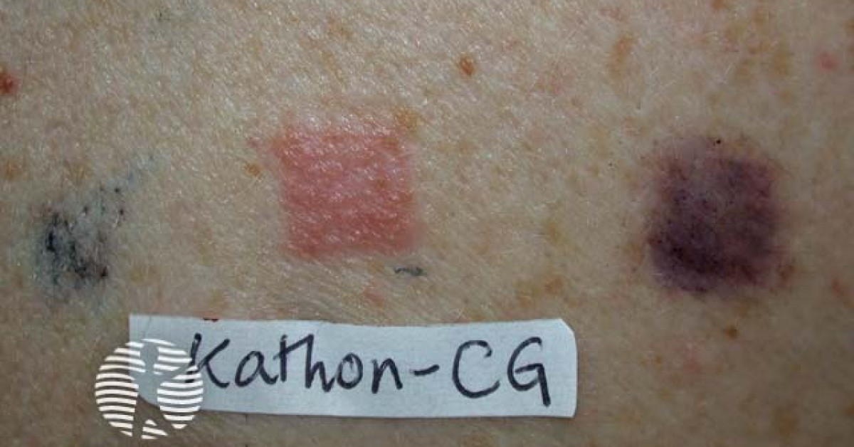Patch test image