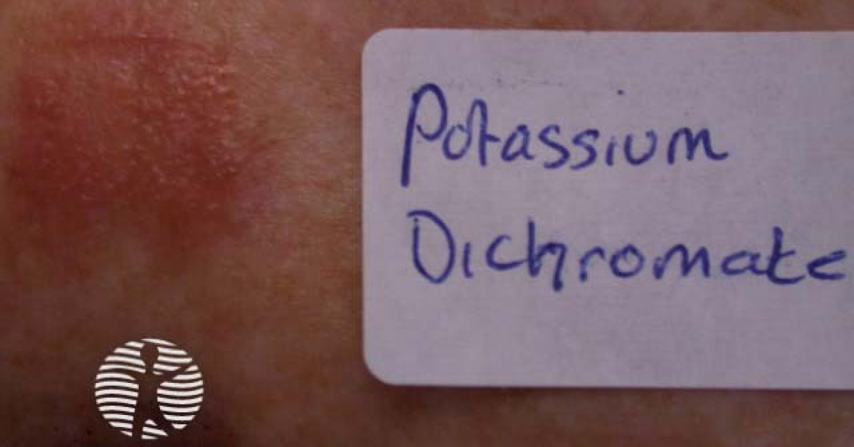 Patch test image