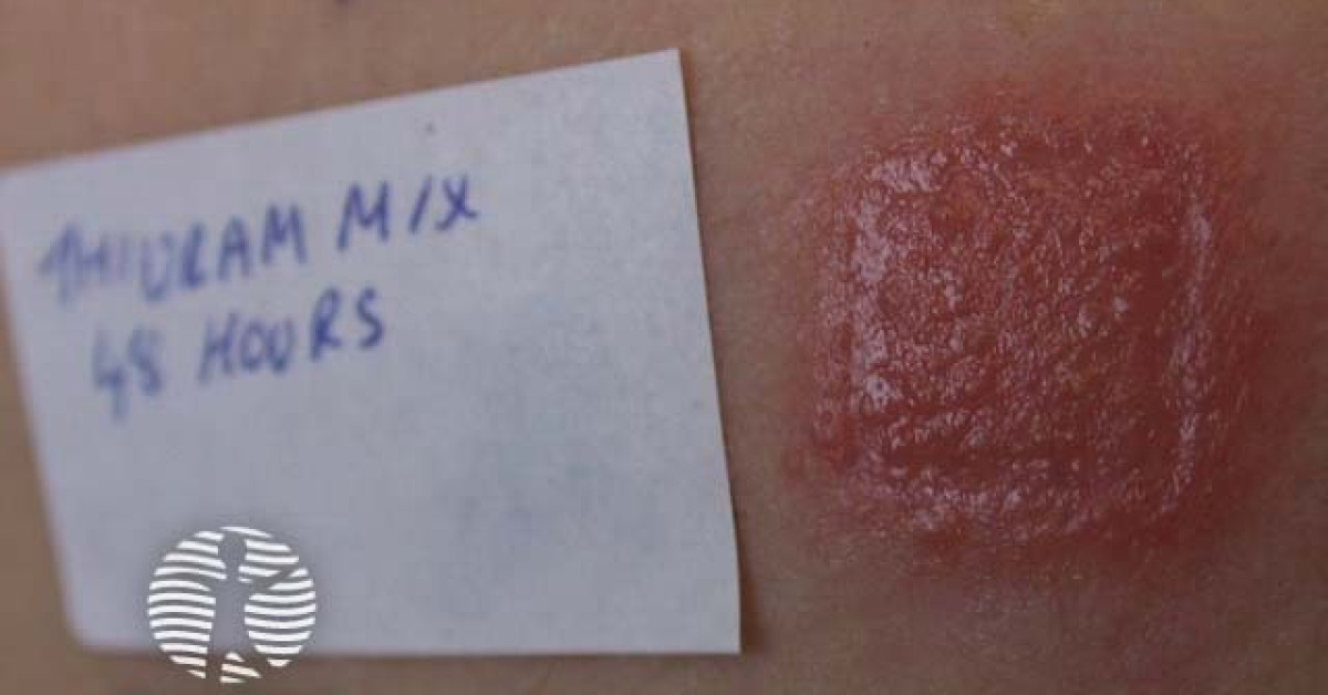 Patch test image