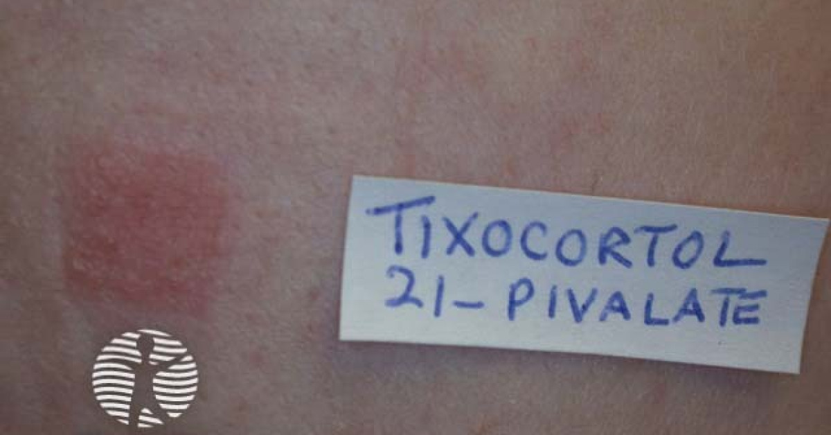Patch test image