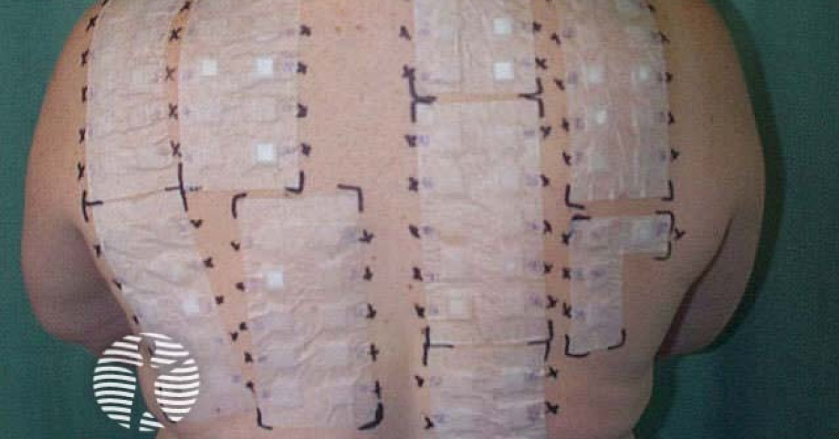 Patch Tests Image