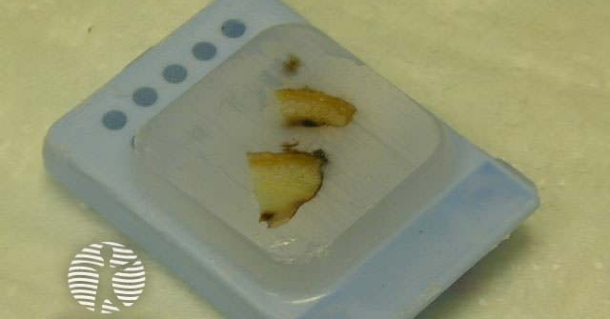 Completed paraffin block image