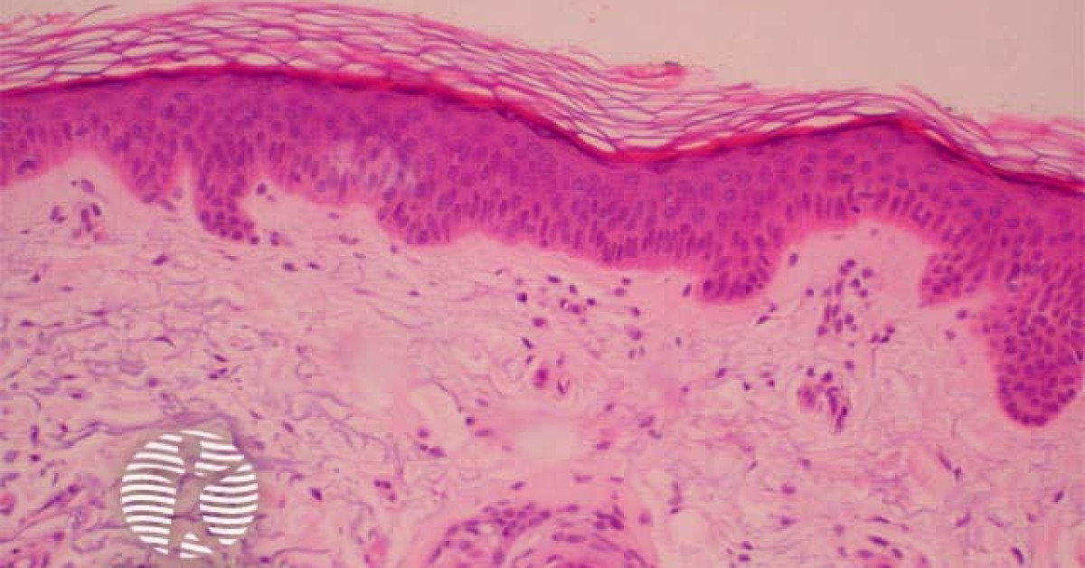 Pathology of normal skin image