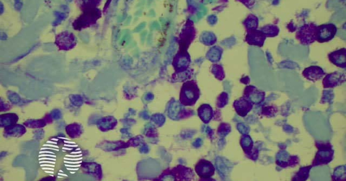 Mast cells stained with toluidine blue image