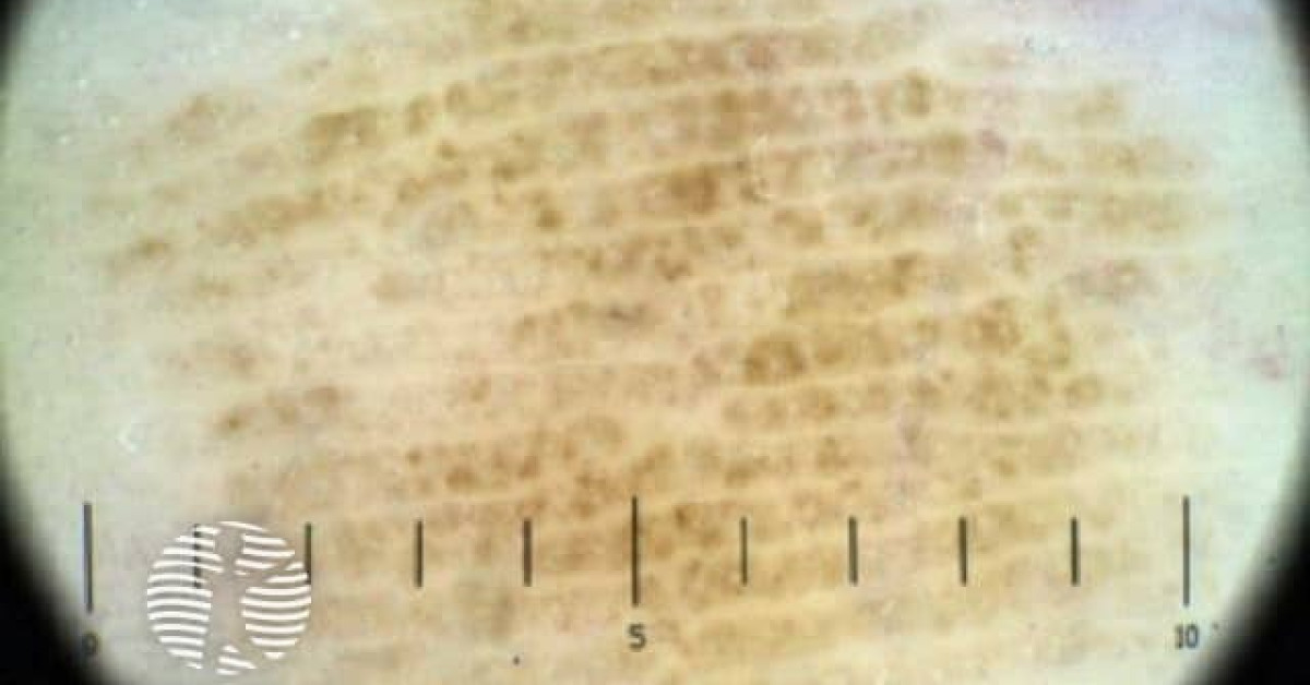 Ridge pattern, parallel image