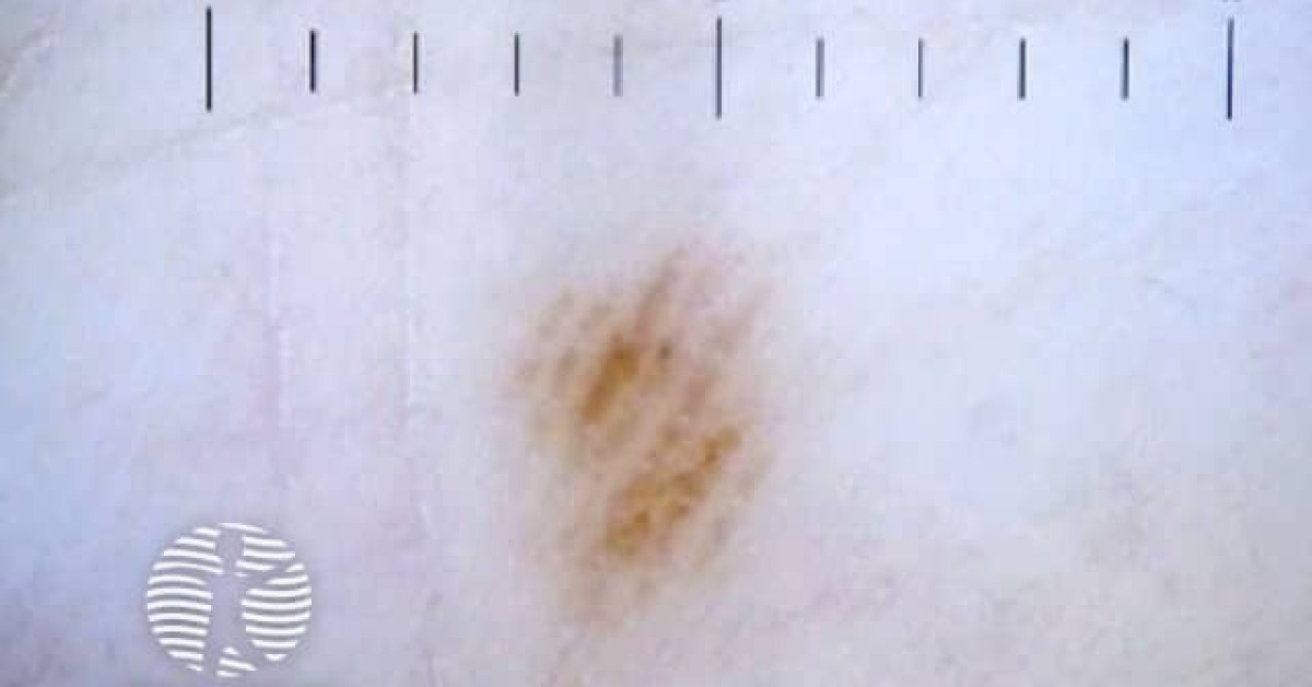 Ridge pattern, parallel image