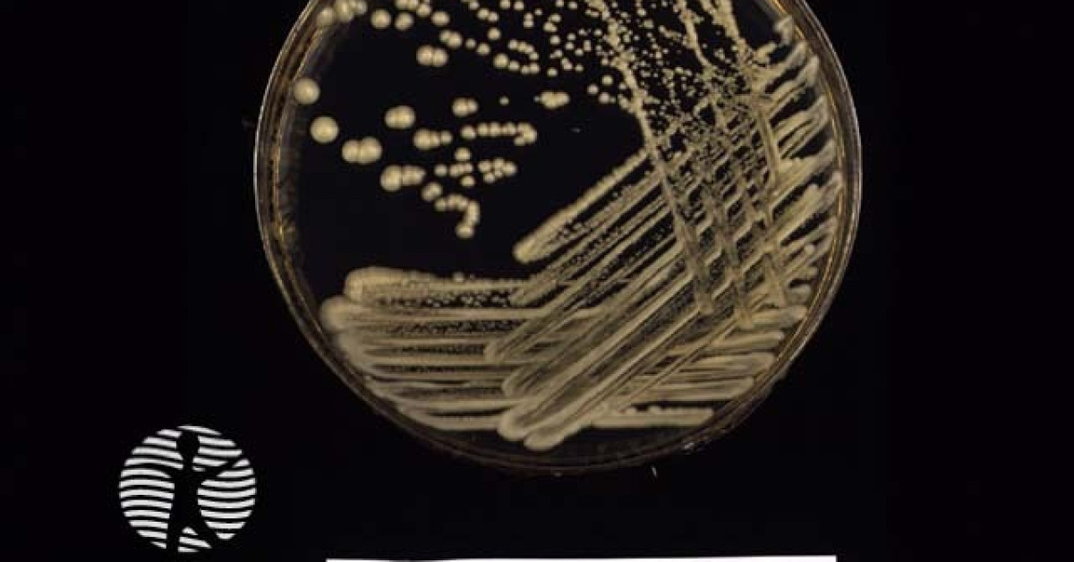 Candida albicans: microscopy and culture image