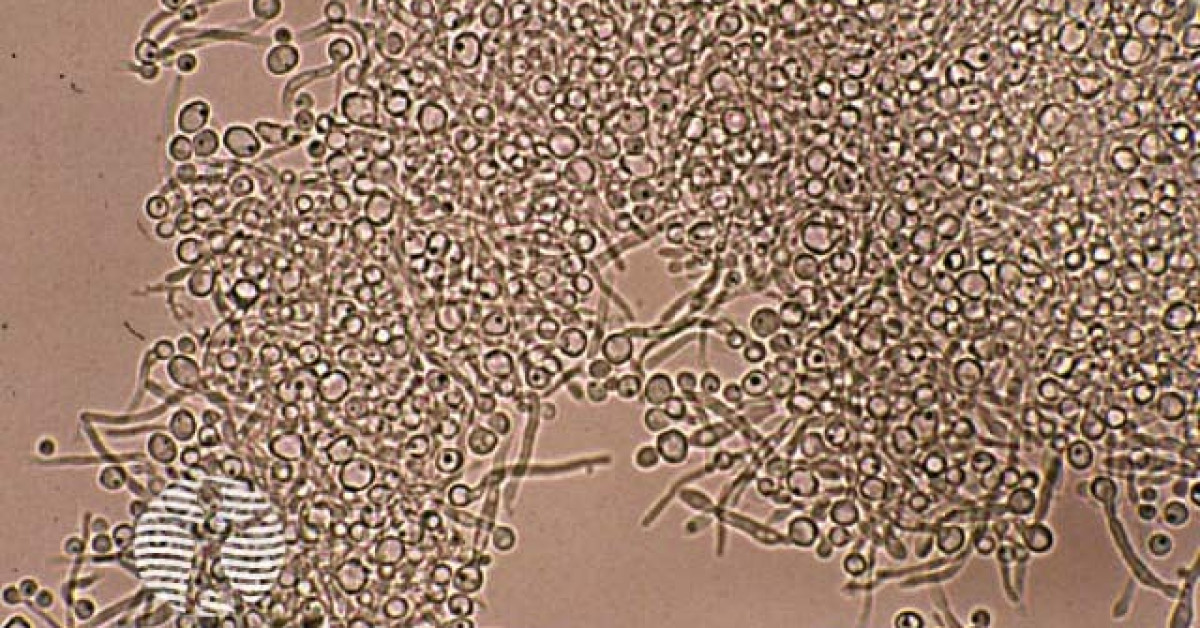 Candida albicans: microscopy and culture image