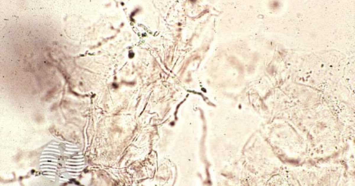 Microscopy of Microsporum canis image