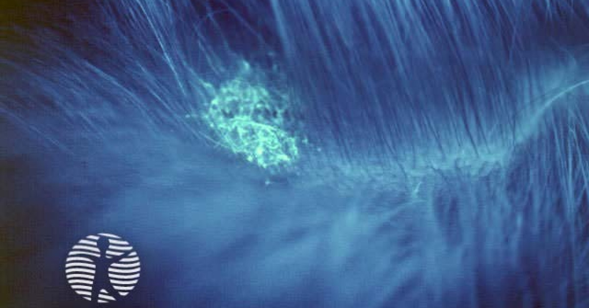 Microsporum canis fluorescence under Wood lamp image