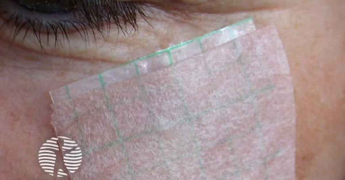 Photodynamic therapy: protection from light image