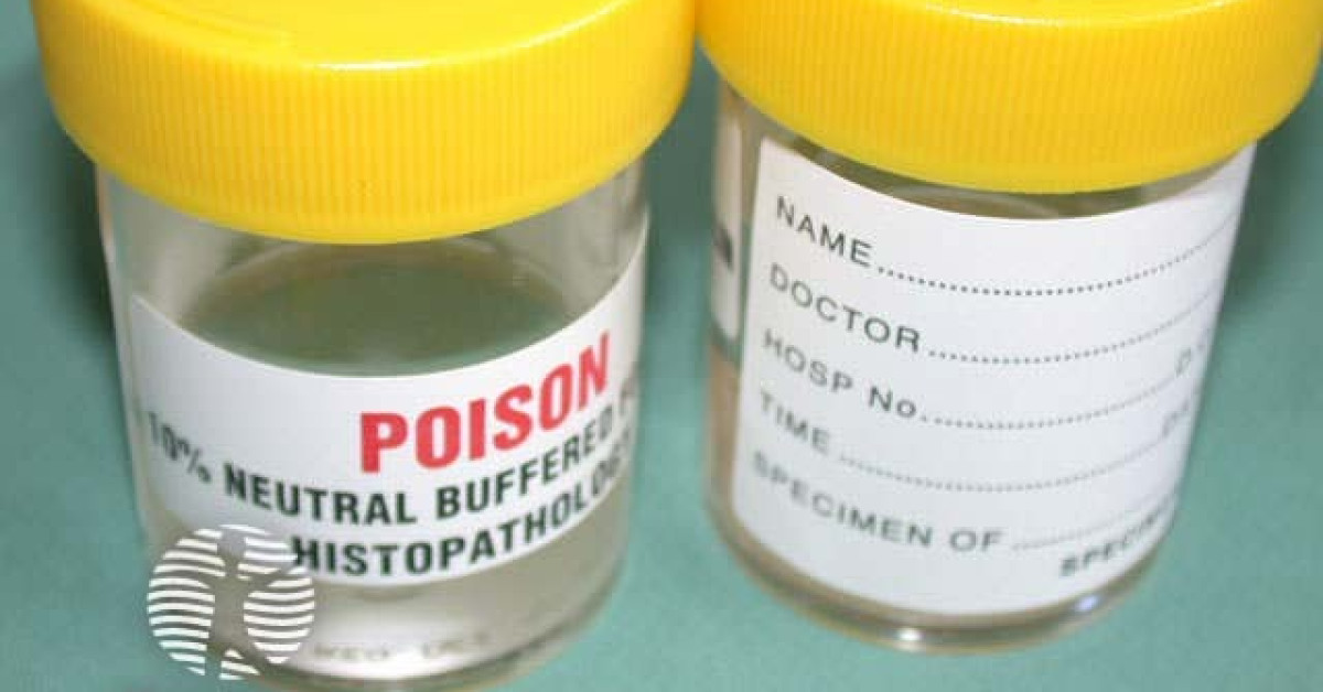 Histology pottles image