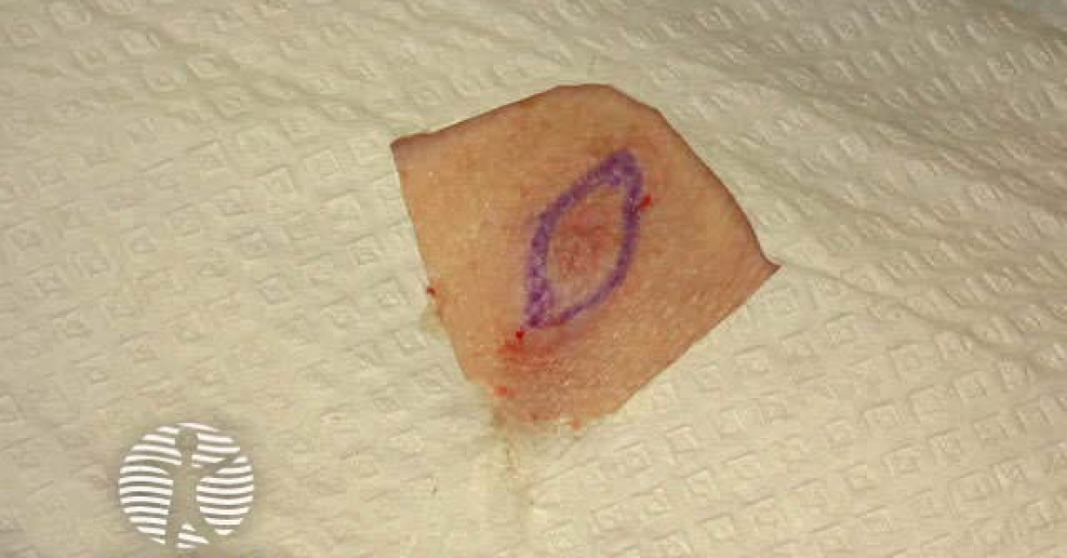 Maintain aseptic technique image