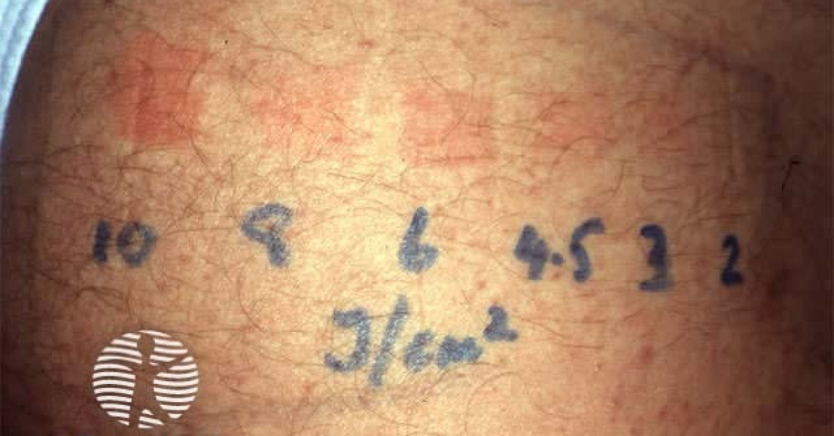 Results of MPD testing image