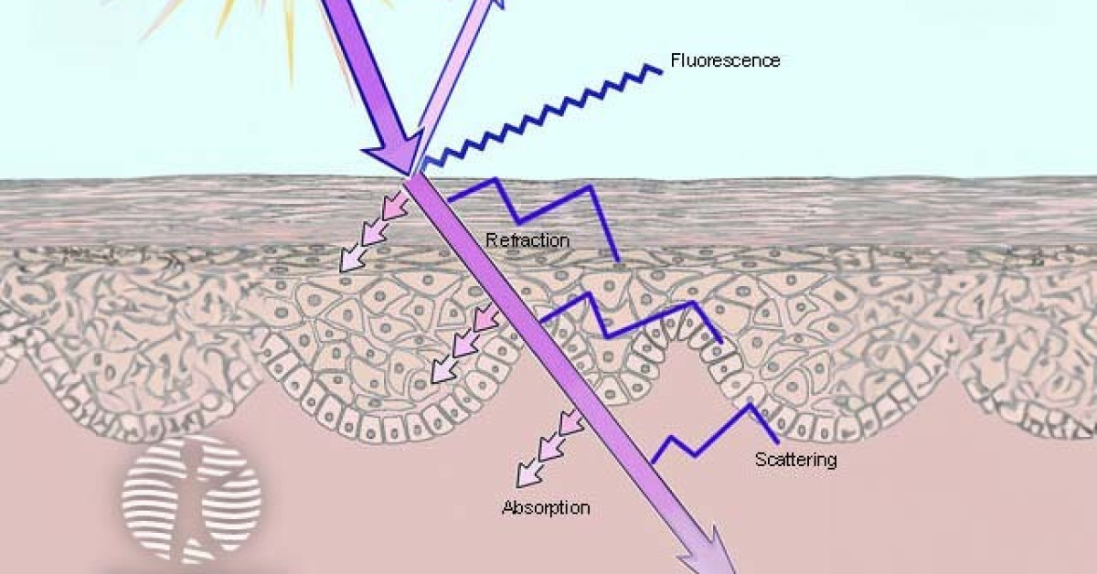 UVR and the skin image