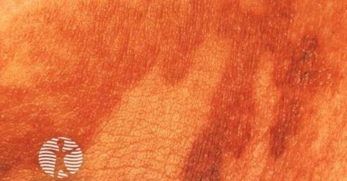 016a image