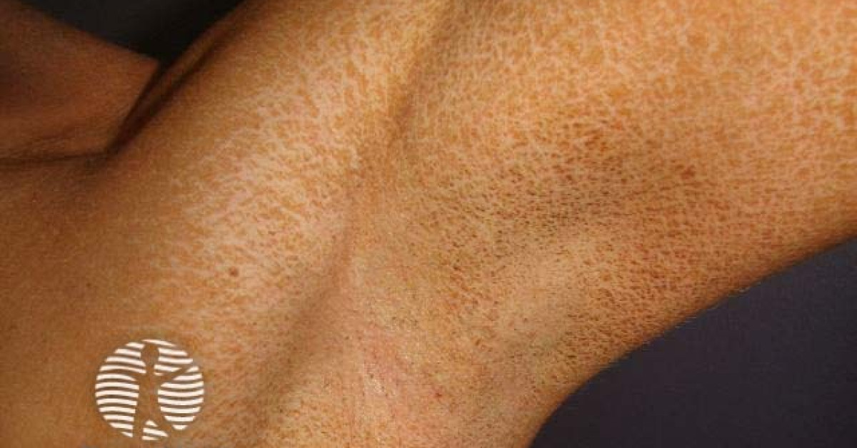 case3 image