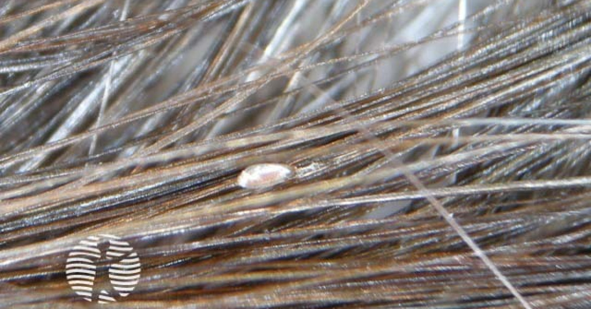 Dermatoscopic examination of hair shaft image