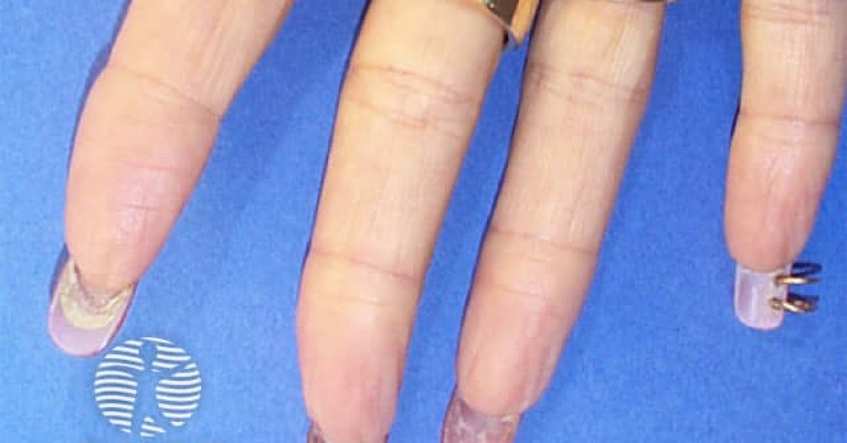 Nail cosmetics image