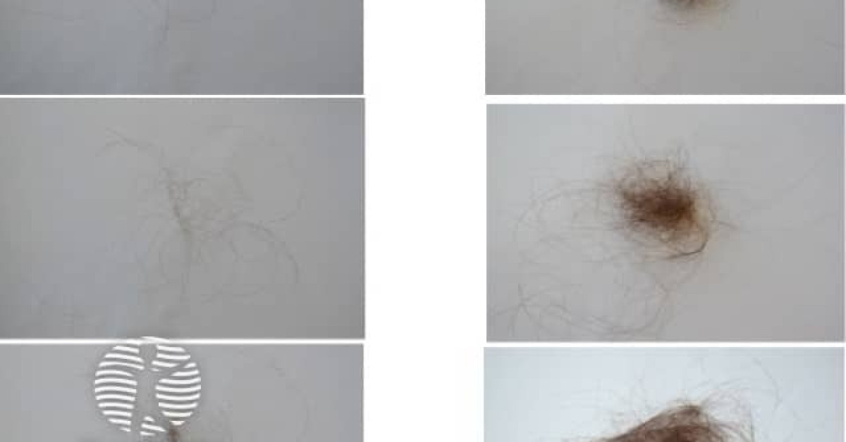 Hair shedding guide image
