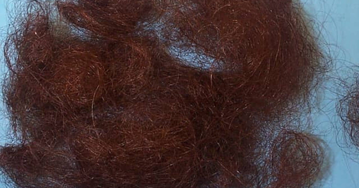 Telogen effluvium image