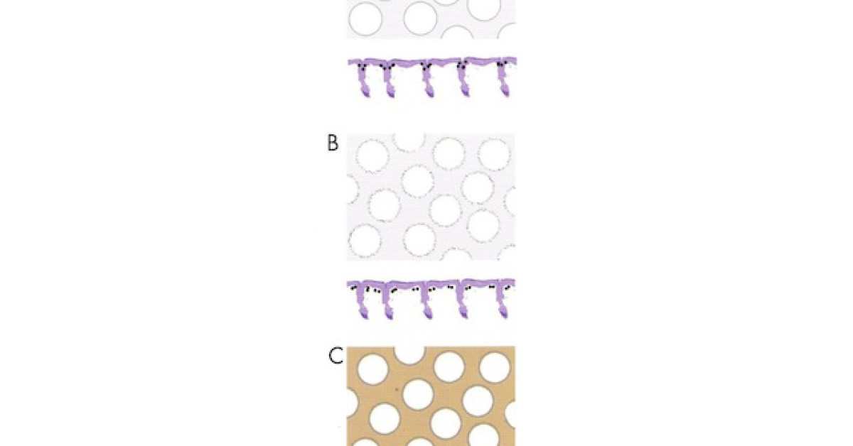Circles on dermatoscopy of facial skin. From Kittler H et al image