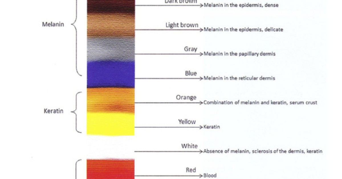 Diagram. Colours in dermatoscopy. From Kittler H et al image