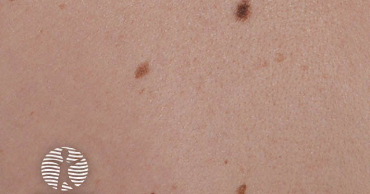 moles image