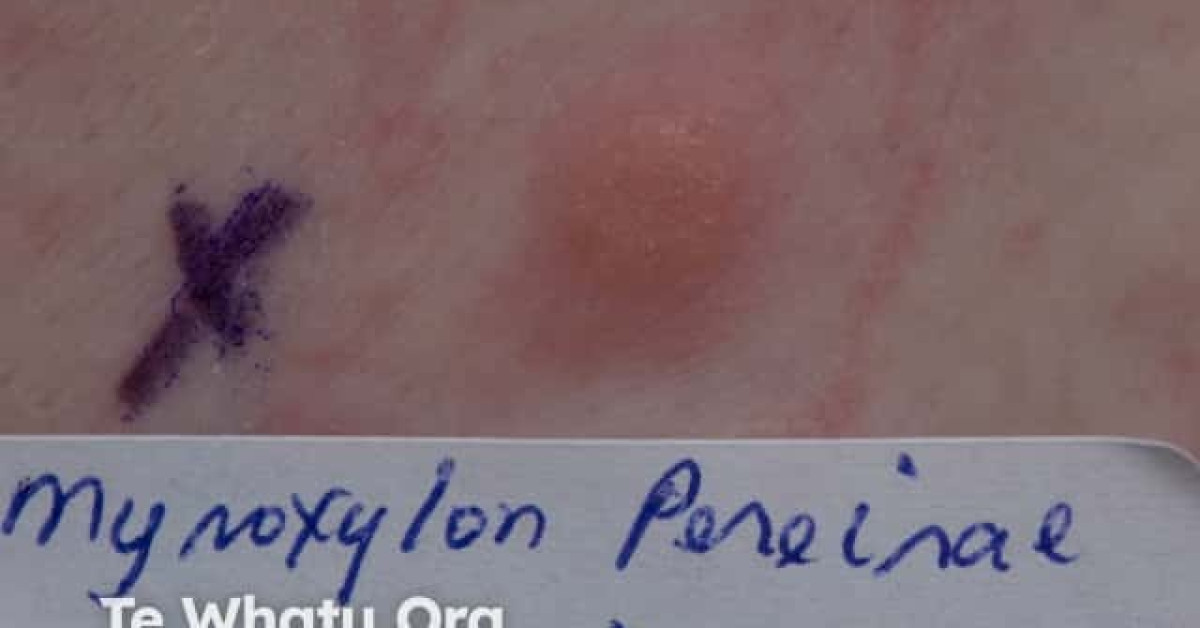 Positive patch test image