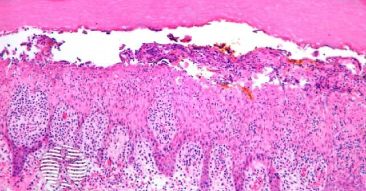 Farmyard pox pathology image