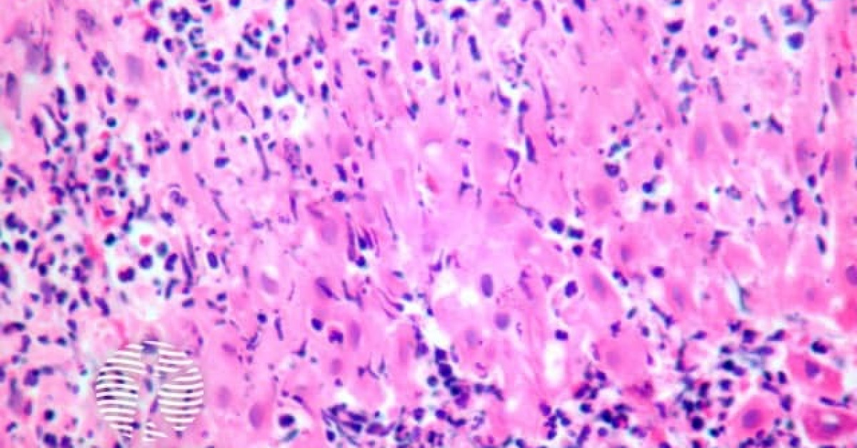 Farmyard pox pathology image