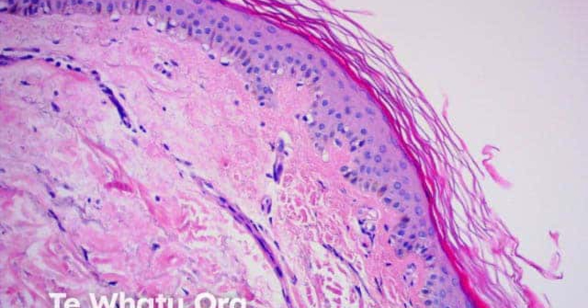 Normal skin pathology with haematoxylin and eosin stain image